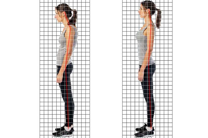 Computerised Posture Analysis